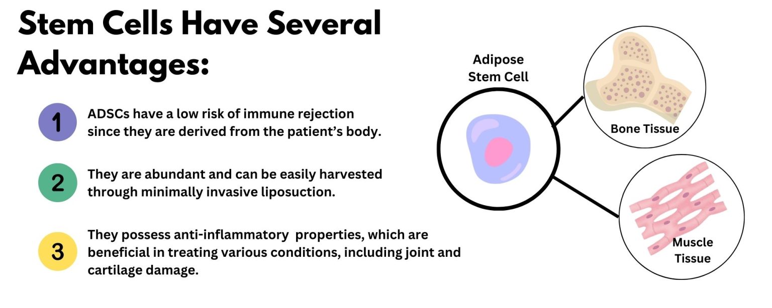 Hip Labral Tears and Stem Cell Treatments: - OPDAHL Regenerative Medicine
